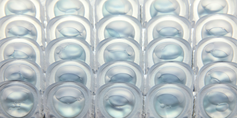 Calculating your contact lens prescription | Lenstore.co.uk