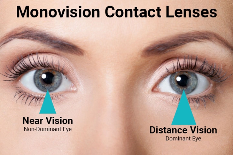 What are monovision contact lenses? | Lenstore.co.uk