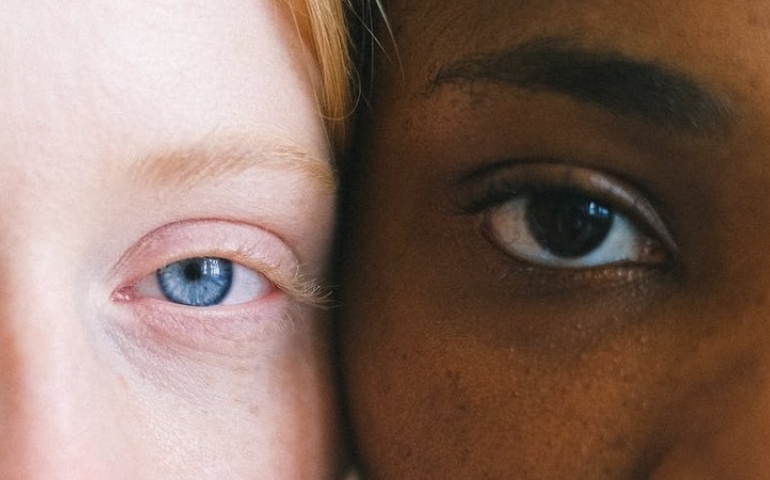 Common eye problems | Lenstore.co.uk